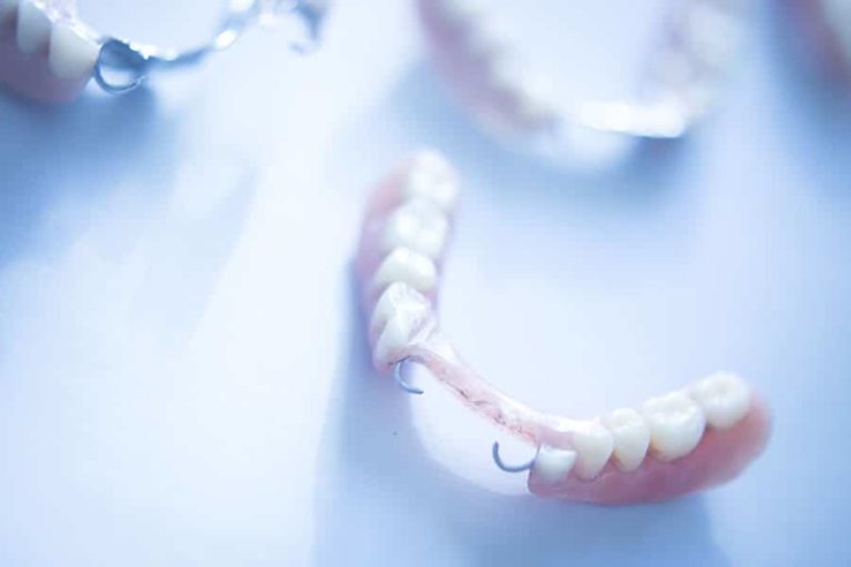 Types of Partial Dentures | East Valley Dental Professionals