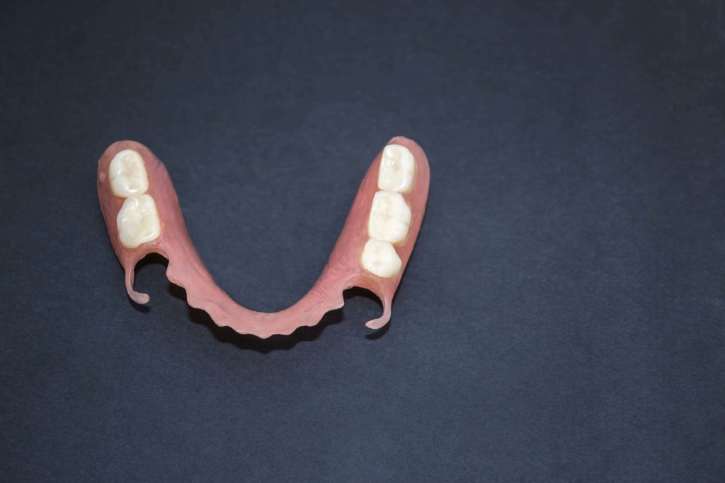 Types of Partial Dentures